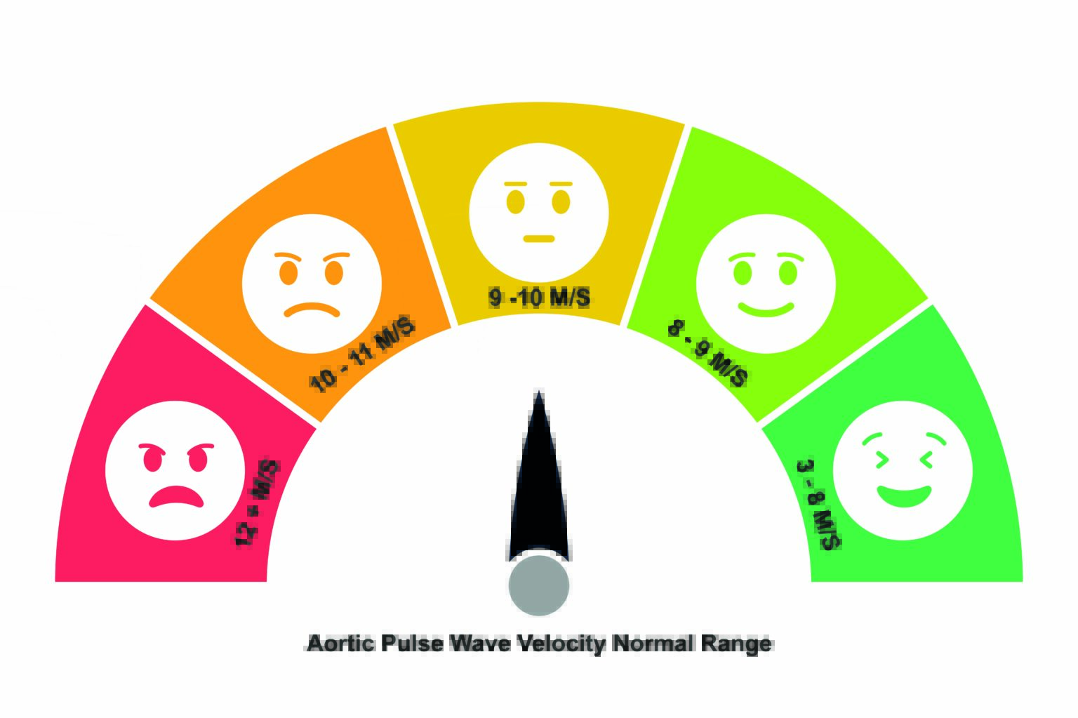 What Is Pulse Wave Velocity? | Arteriograph Company
